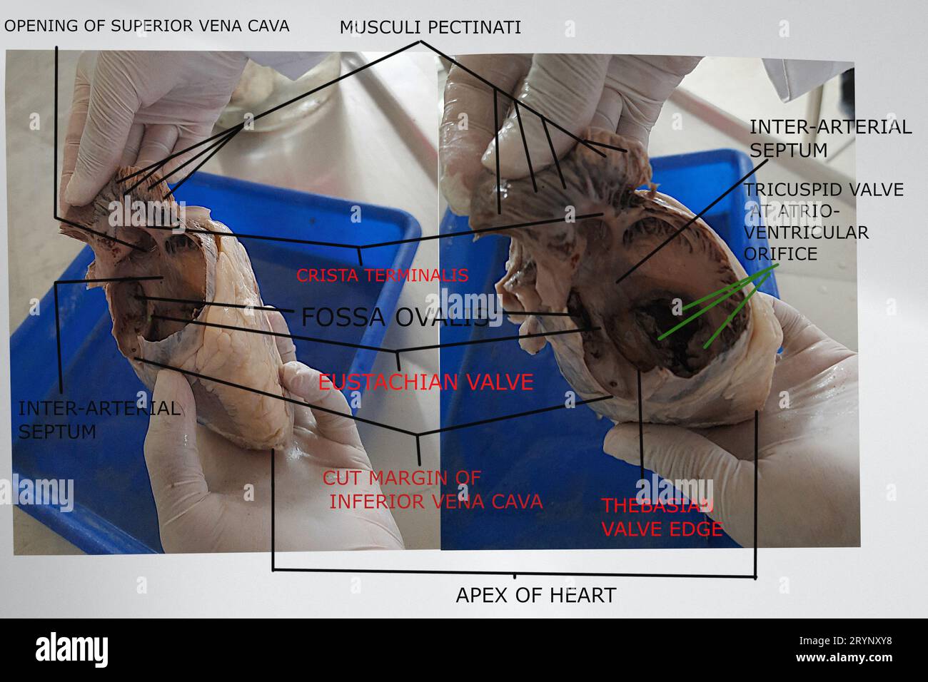 Crista terminalis hi-res stock photography and images - Alamy