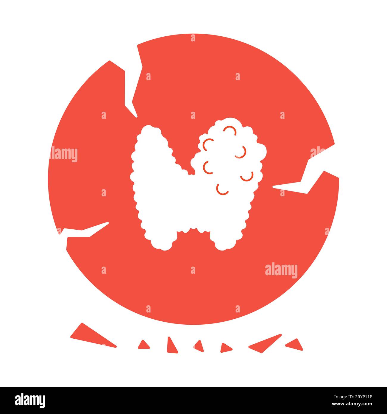 Thyroid Gland With Goiter Disease Awareness Poster Stock Vector Image And Art Alamy