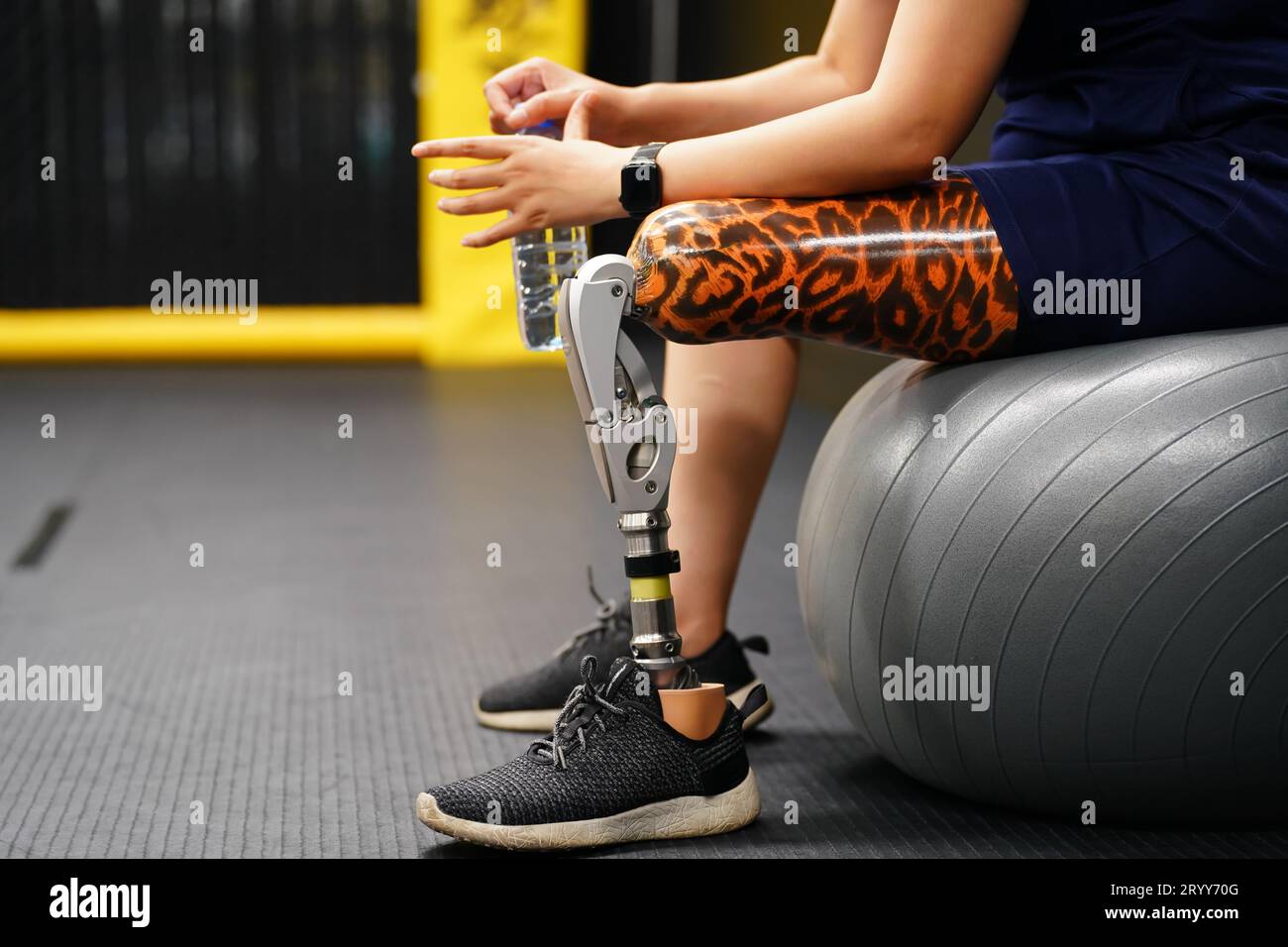 Young female with one prosthetic leg with the practice of using ...