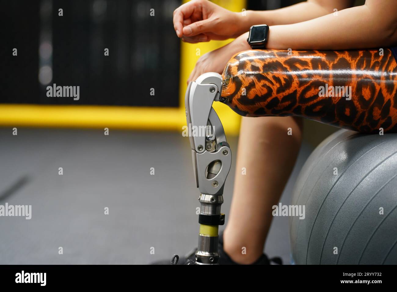 Young female with one prosthetic leg with the practice of using ...