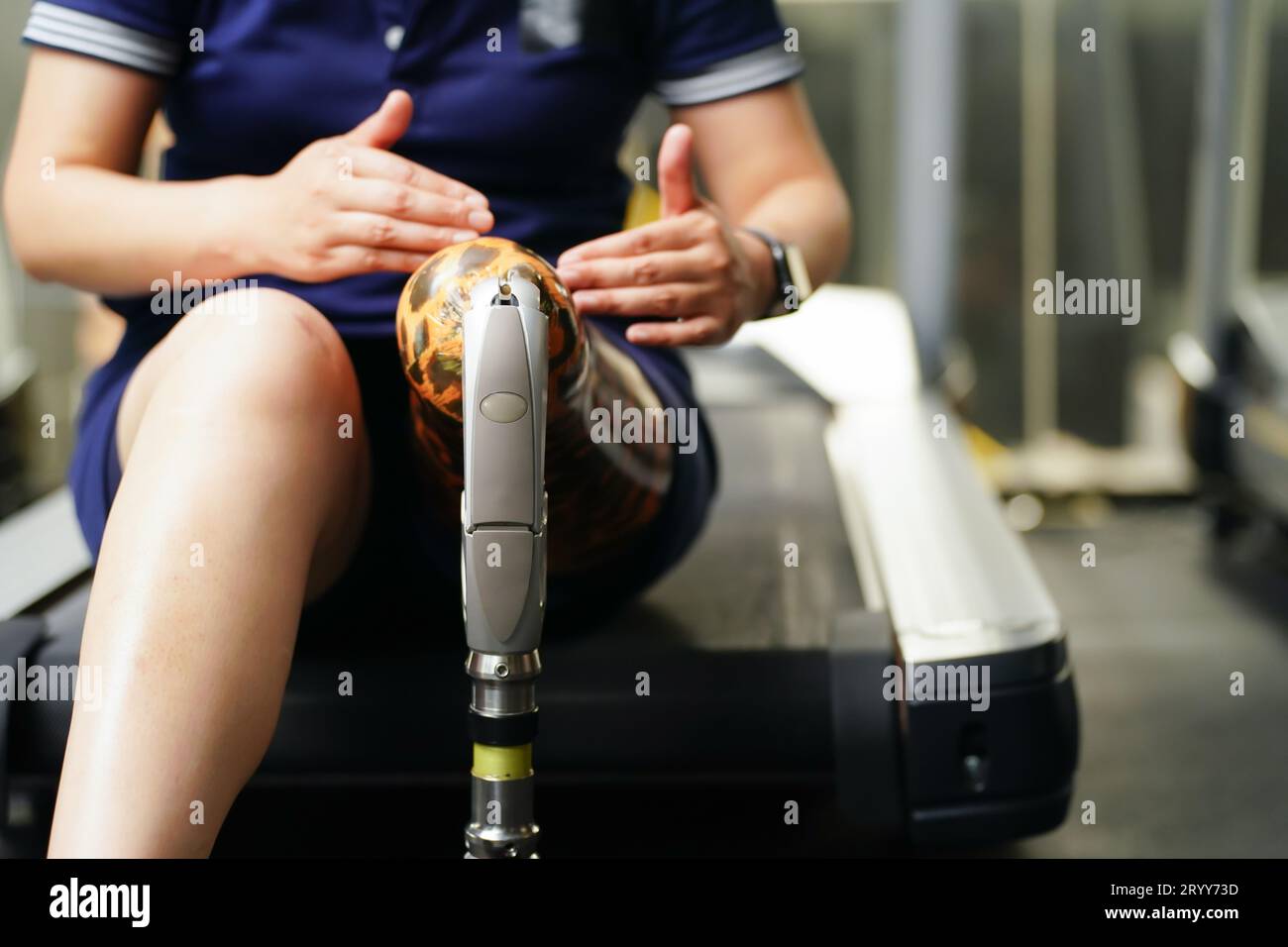 Young female with one prosthetic leg with the practice of using ...