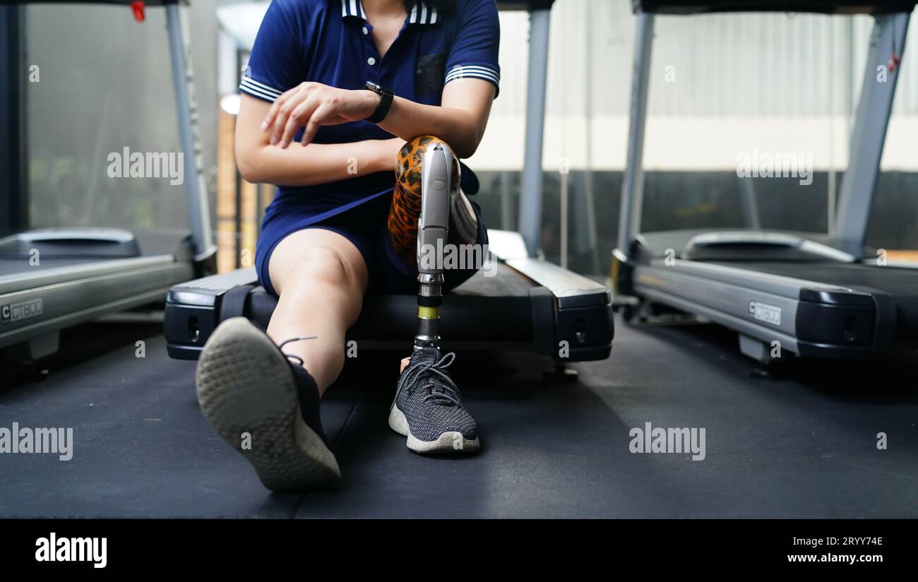 Amputee woman one leg hi-res stock photography and images - Alamy