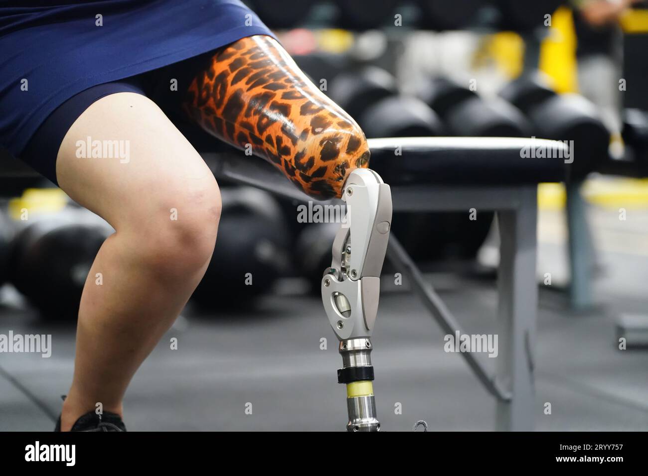 Young female with one prosthetic leg with the practice of using ...
