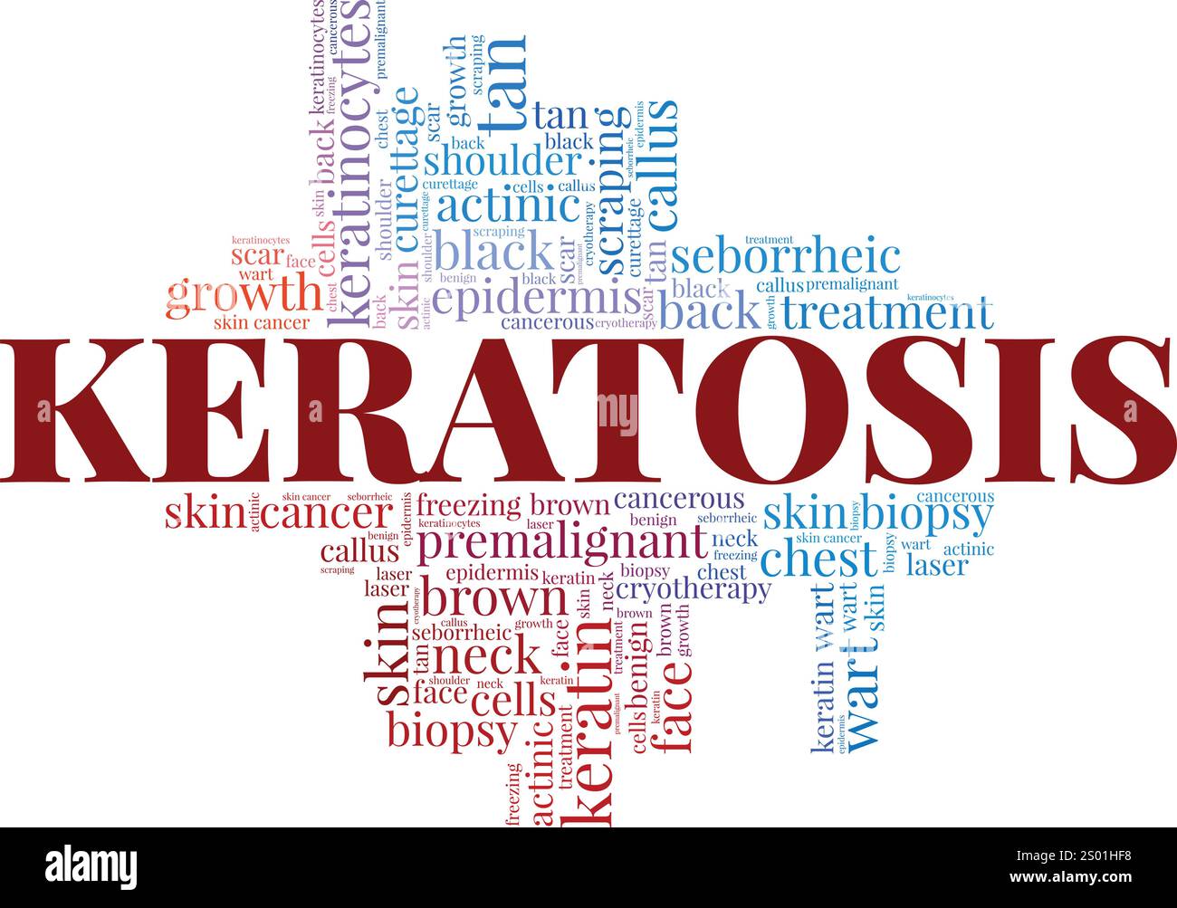 Keratosis word cloud conceptual design isolated on white background ...