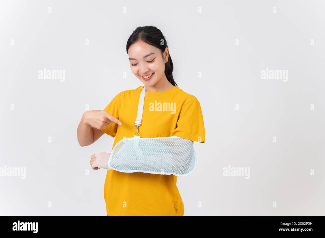 A happy Asian woman pointing at her broken arm, wrapped in a plaster ...
