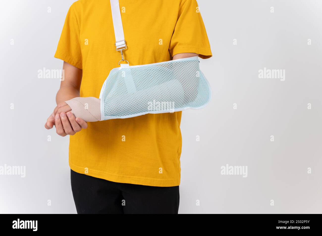 A close-up of a woman with a broken arm wrapped in a plaster bandage ...