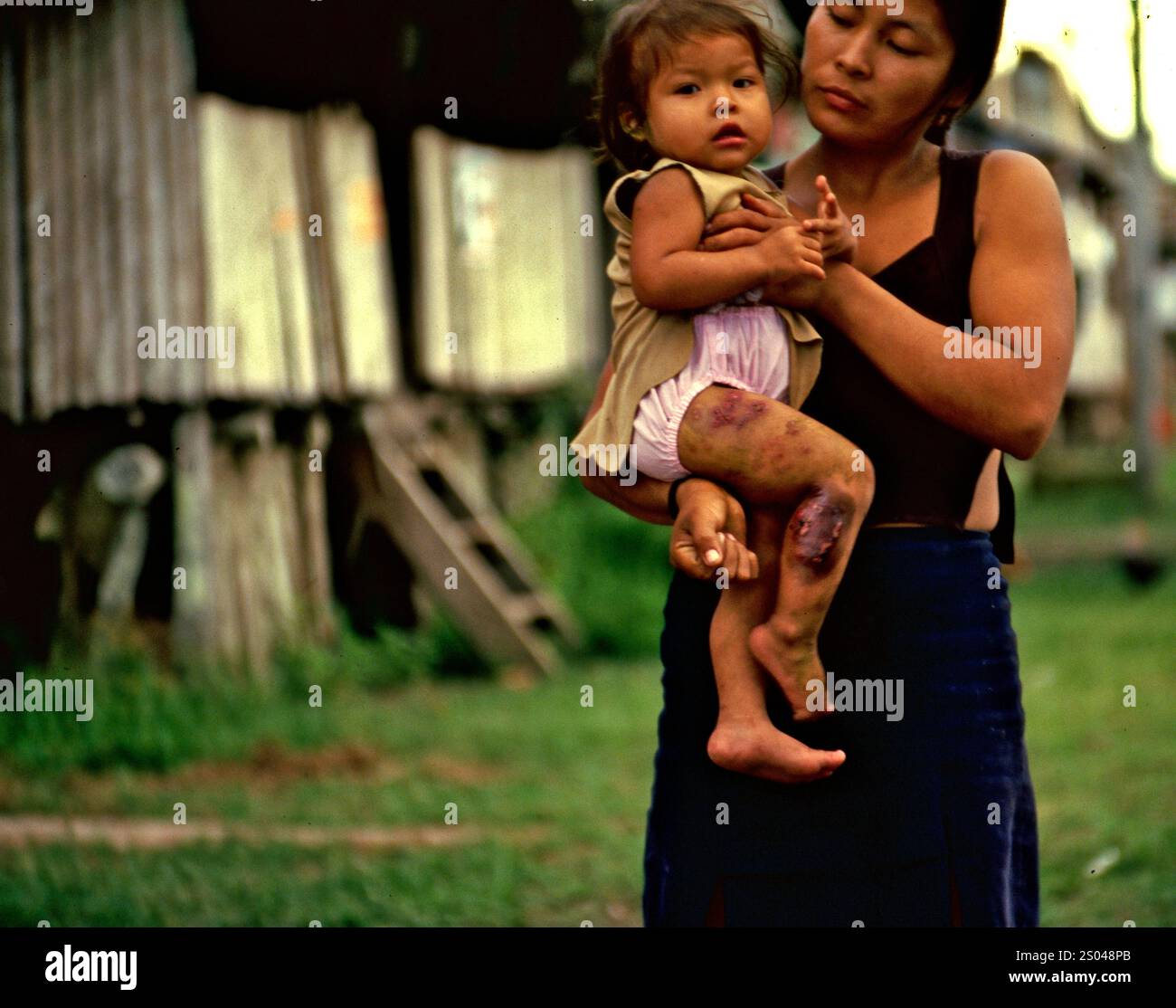 In a small, indigenous Cocama community in Peru, this todler had spilt ...