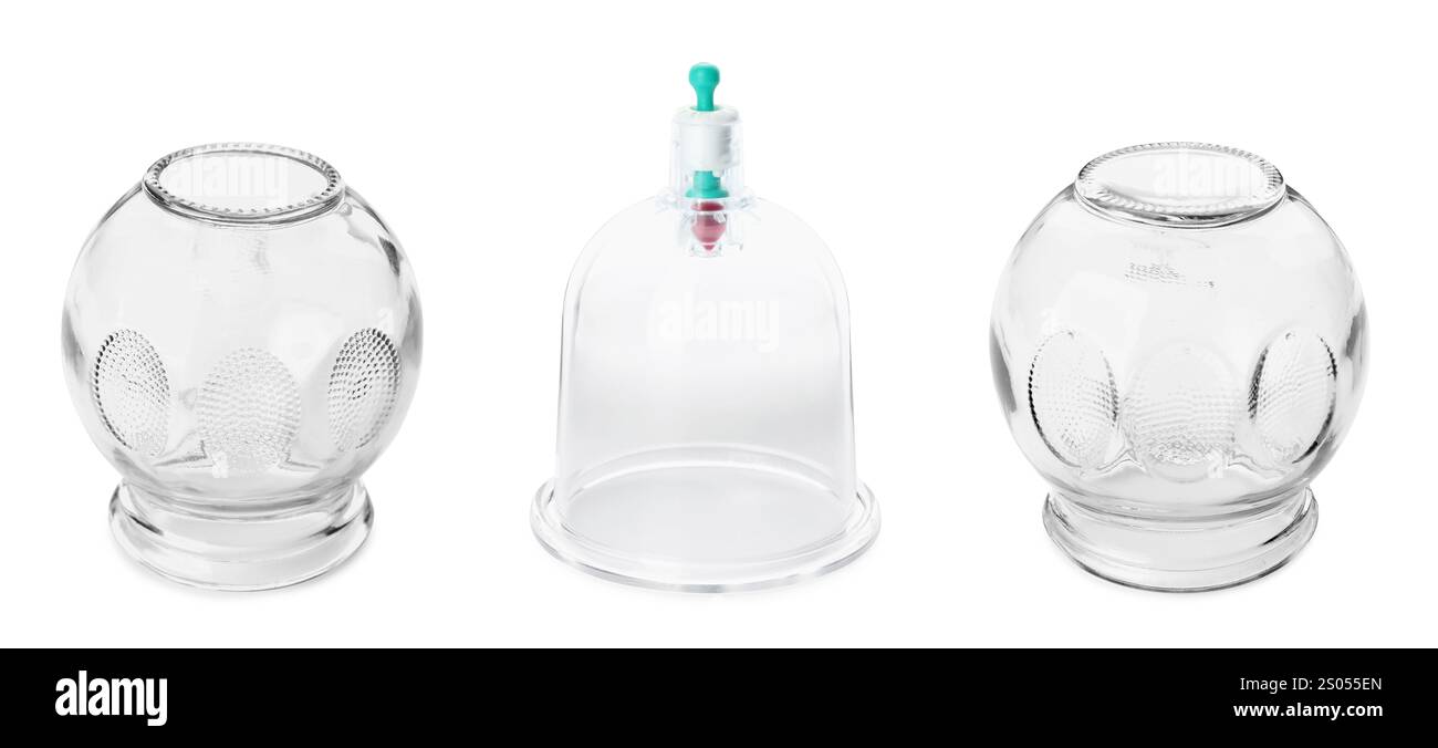 Cupping therapy. Glass and plastic cups isolated on white, collage ...