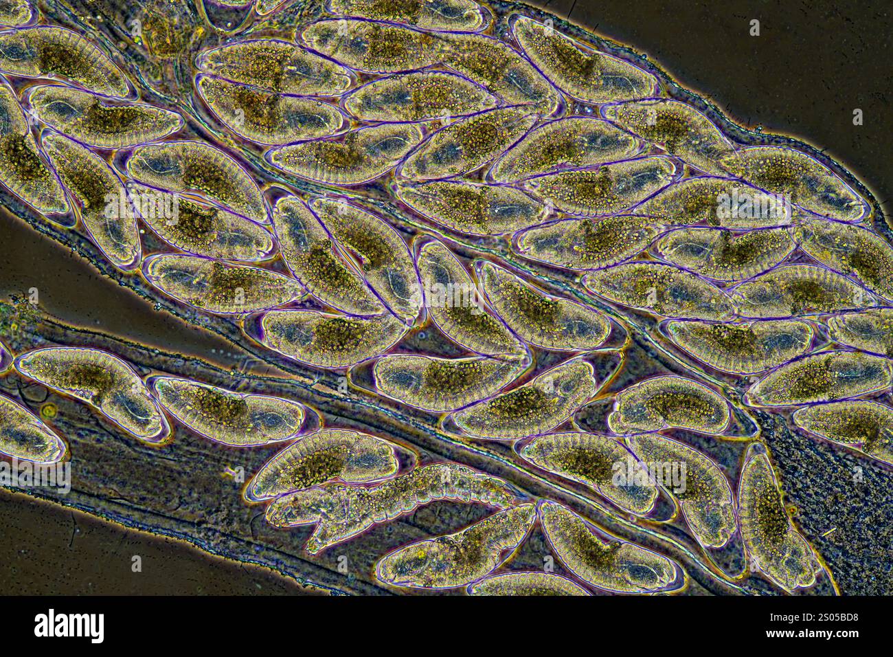 Phase contrast light micrograph of chironomid lake fly eggs. In the ...