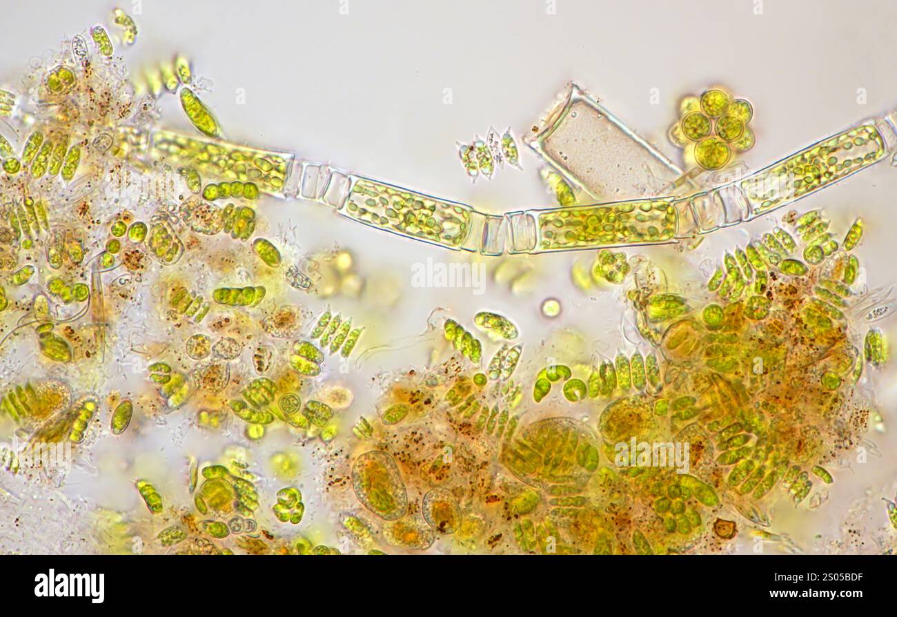 Bright-field light micrograph of various tiny green algae, mostly ...