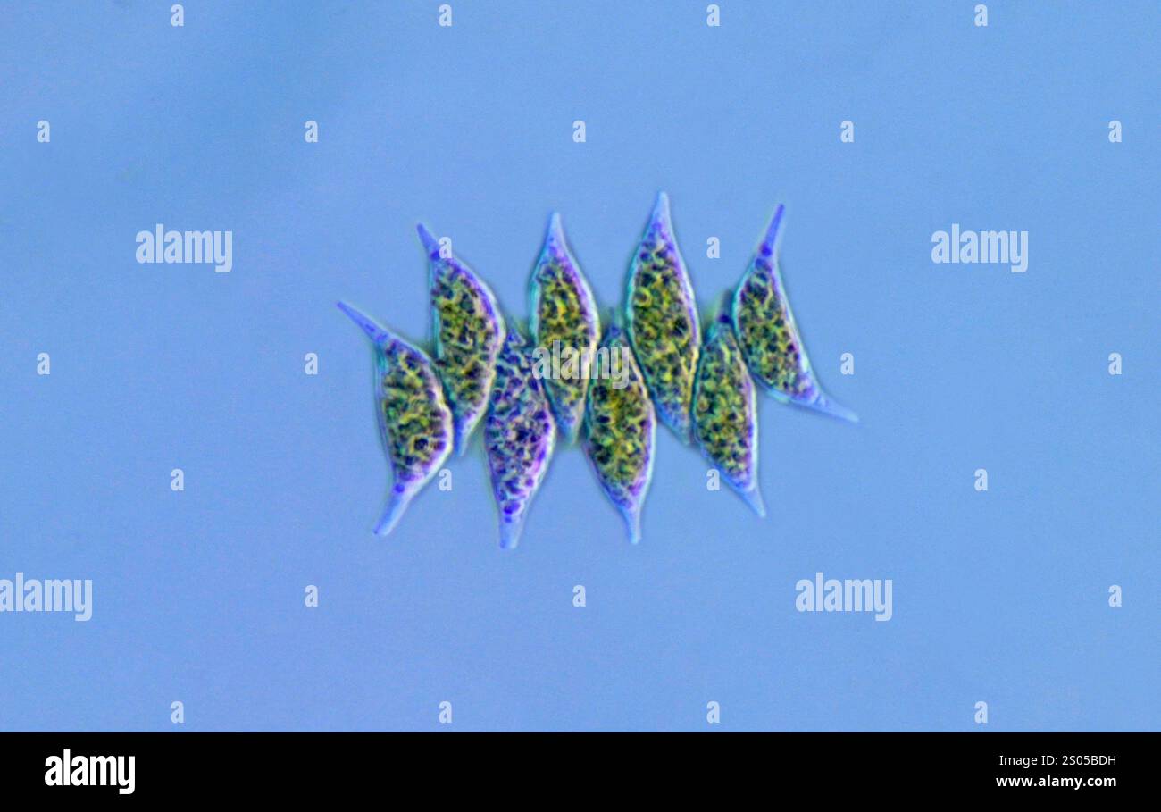 Polarised light micrograph of Scenedesmus sp. green alga. Scenedesmus ...