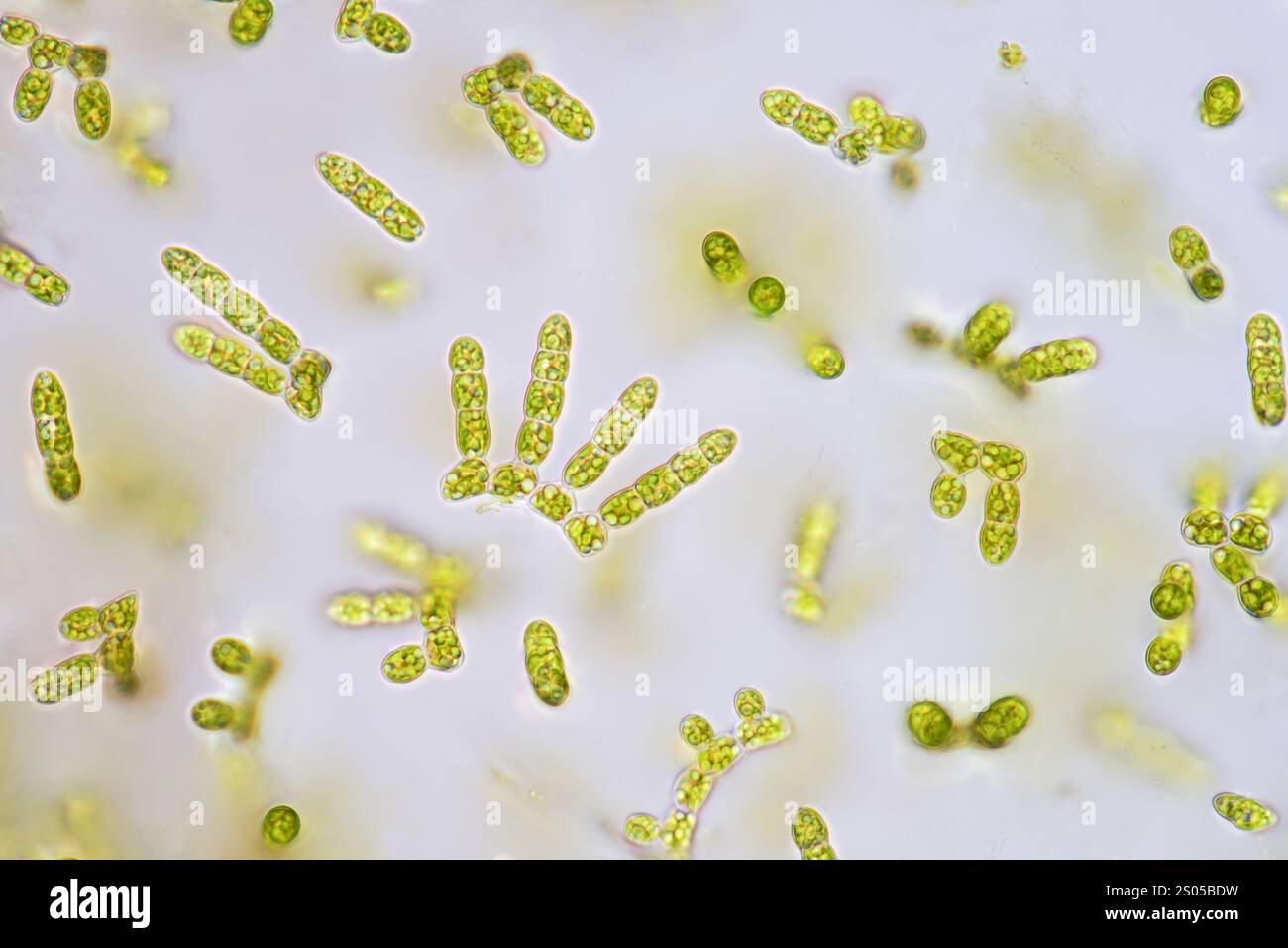 Bright-field light micrograph of various tiny green algae. Green algae ...