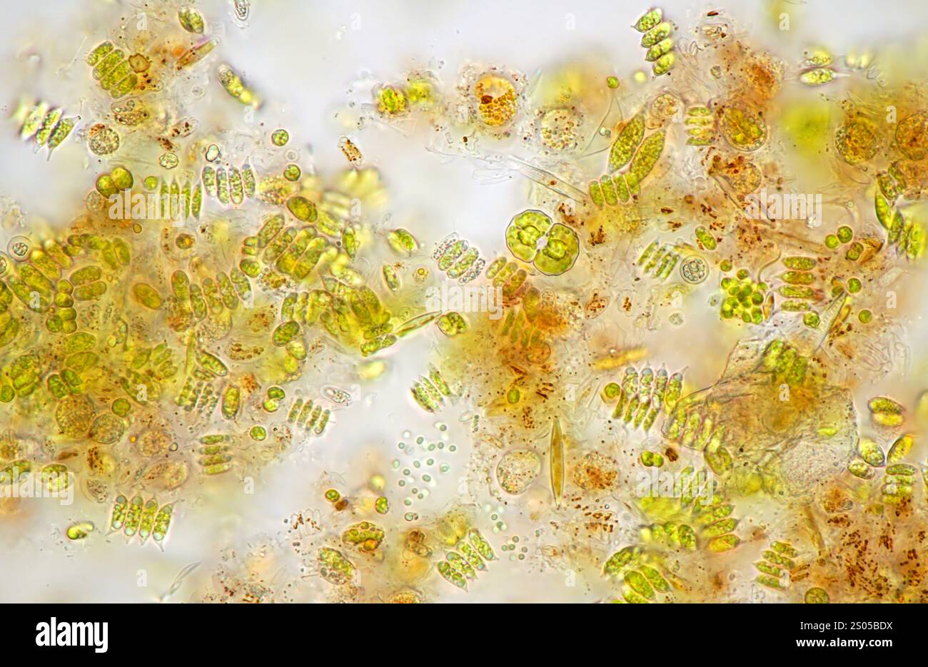 Bright-field light micrograph of various tiny green algae, mostly ...