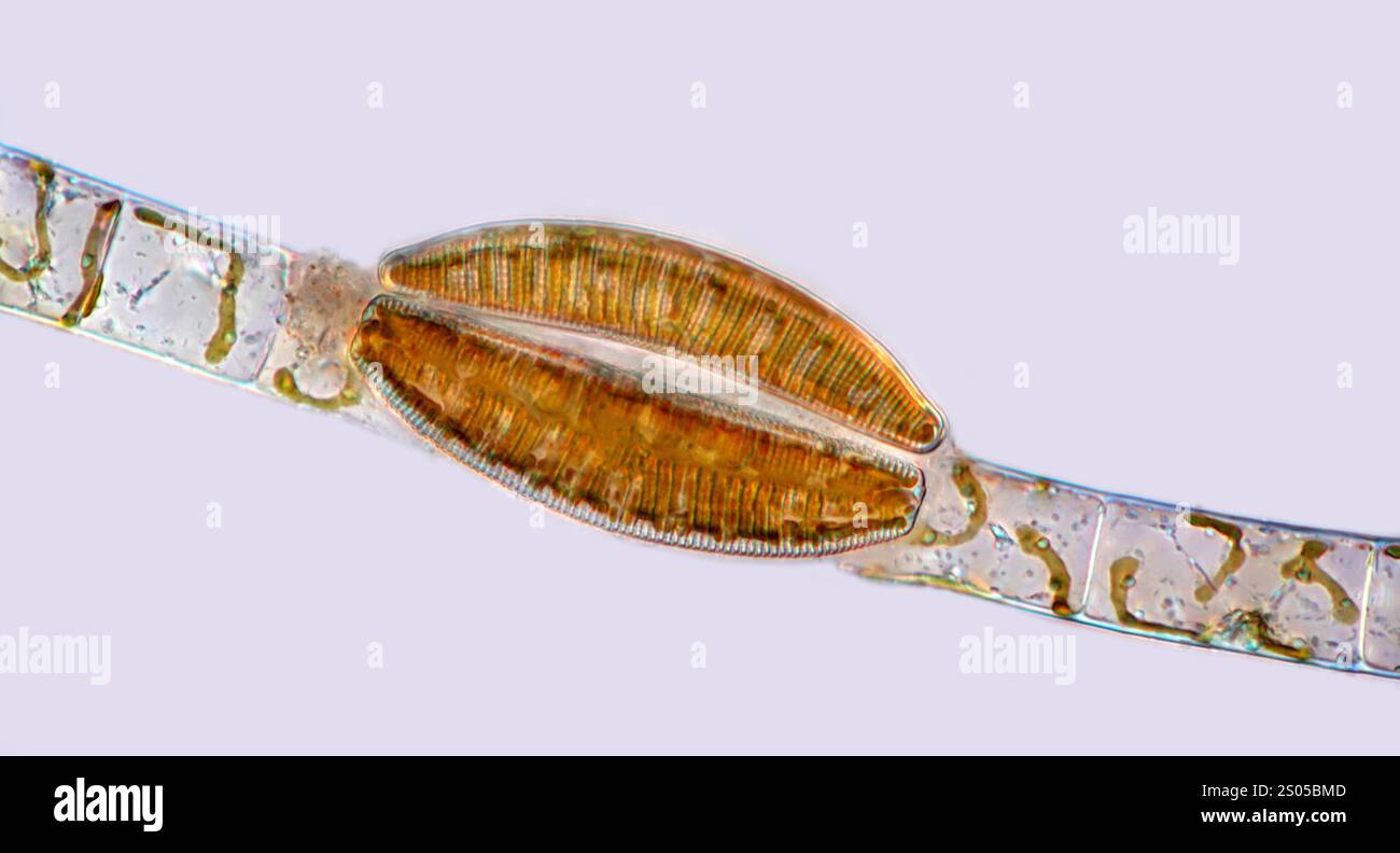 Polarised light micrograph of a marine diatom attached to a red algae ...