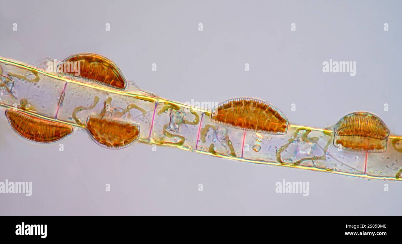 Polarised light micrograph of marine diatoms attached to a red algae ...