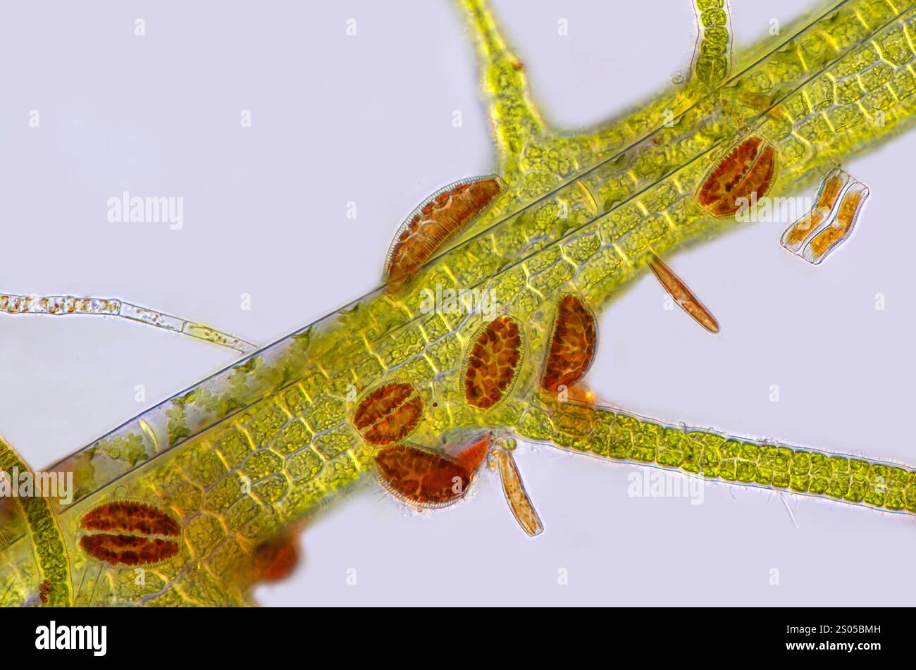 Polarised light micrograph of marine diatoms (Achnanthes sp.) attached ...