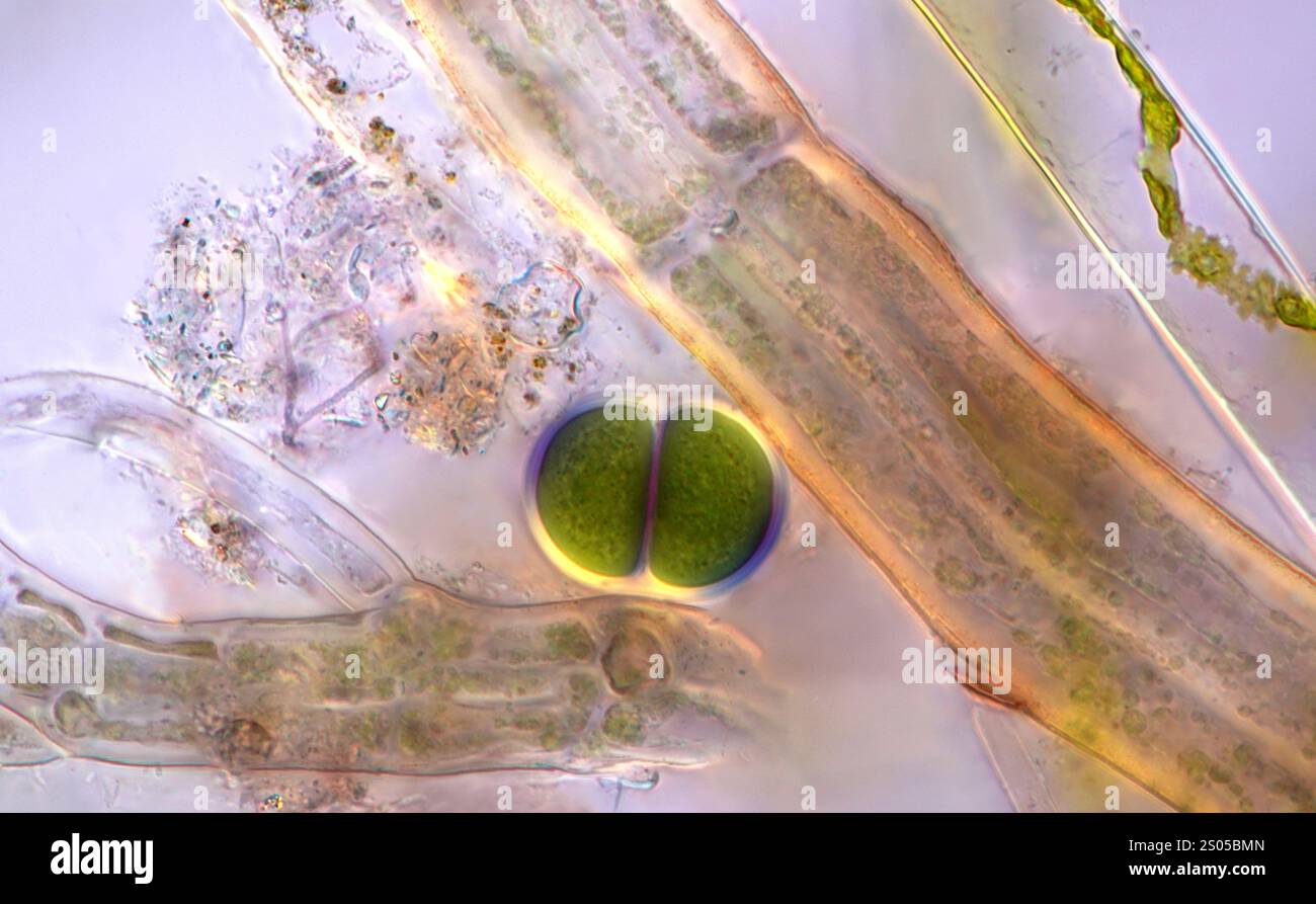 Chroococcus sp. cyanobacteria and red alga, light micrograph Stock ...