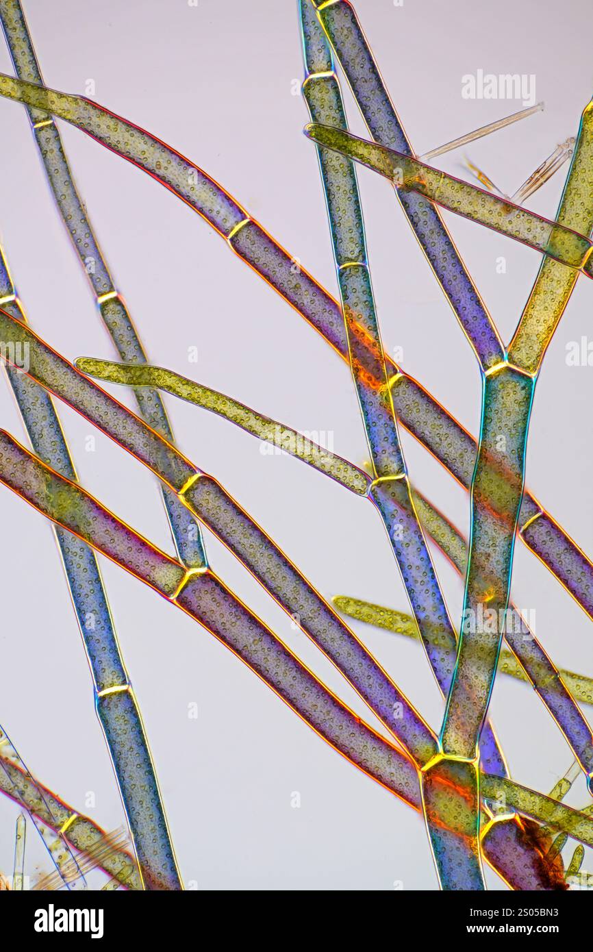 Polarised light micrograph of Cladophora green algae from the Baltic ...