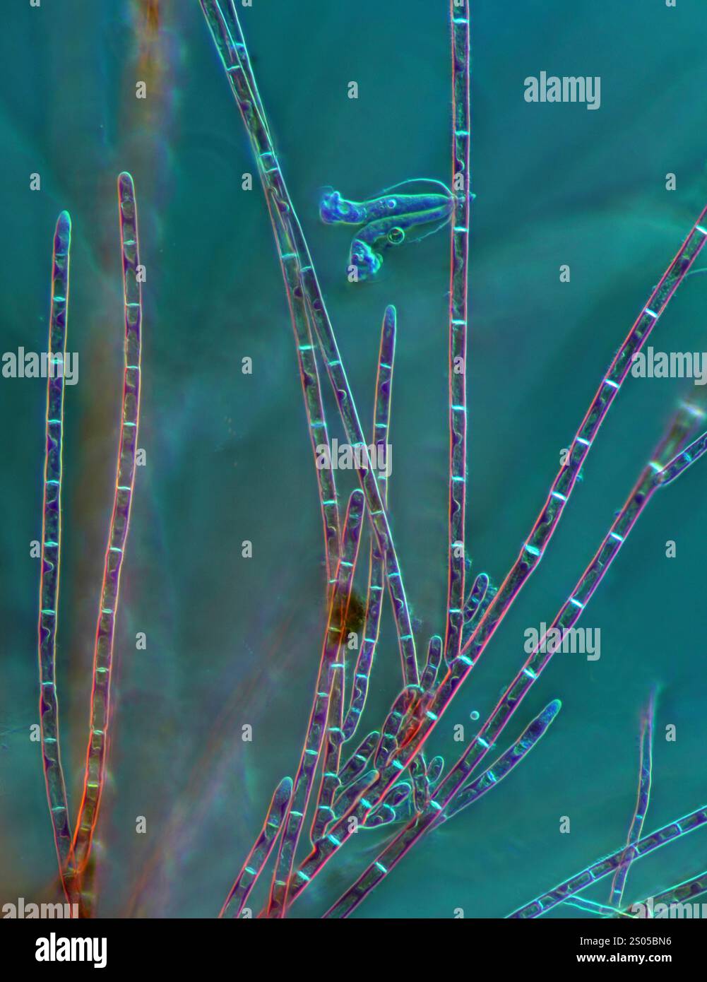 Polarised light micrograph of Platycola sp. ciliates attached to red ...