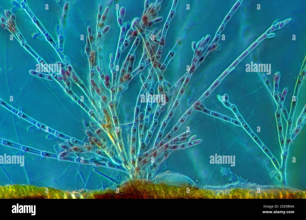 Polarised light micrograph of red algae from the Baltic Sea. Algae is ...