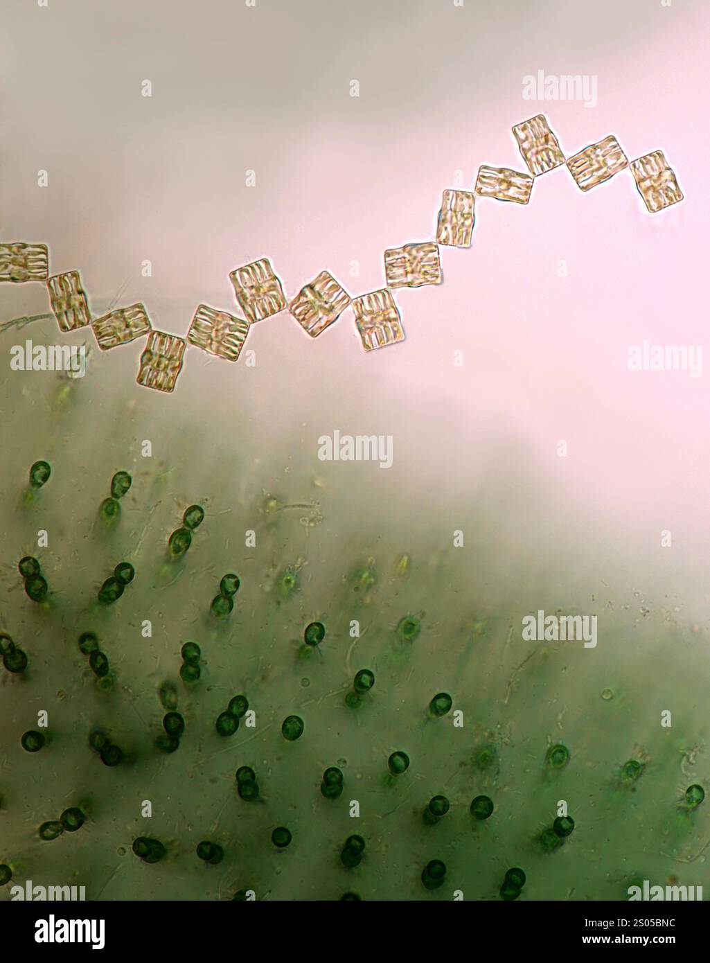 Bright field light micrograph of Tabellaria sp. diatoms and ...