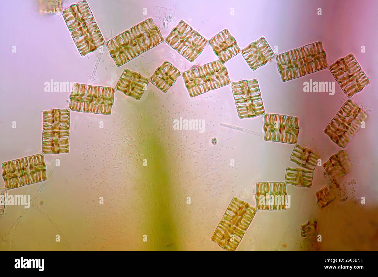 Polarised light micrograph of Tabellaria sp. diatoms. Tabellaria is a ...