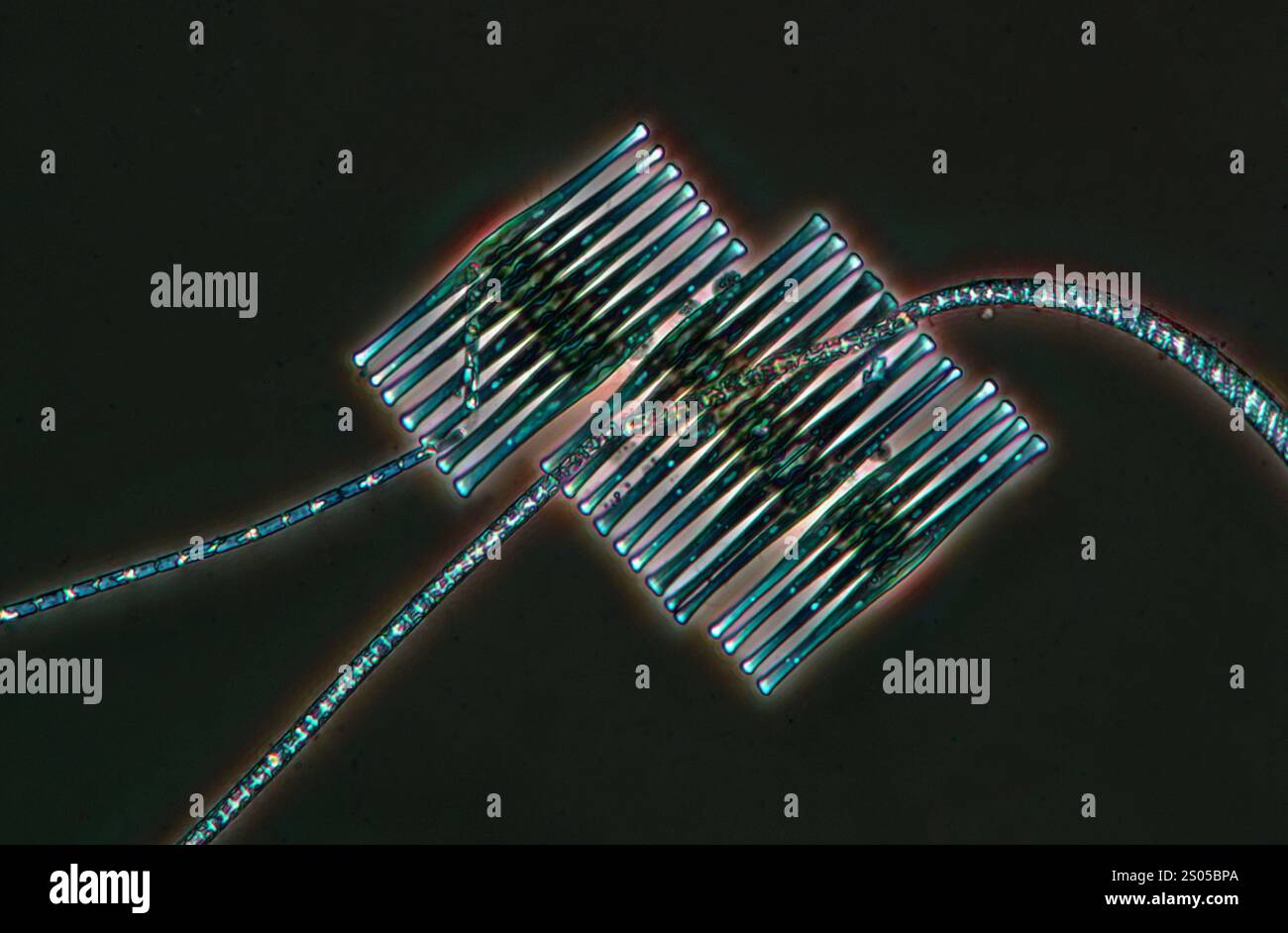 Phase contrast light micrograph of a Fragilaria sp. diatom (filamentous ...