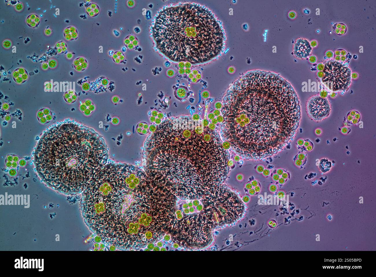Polarised light micrograph of a spongomonad flagellated protist and ...