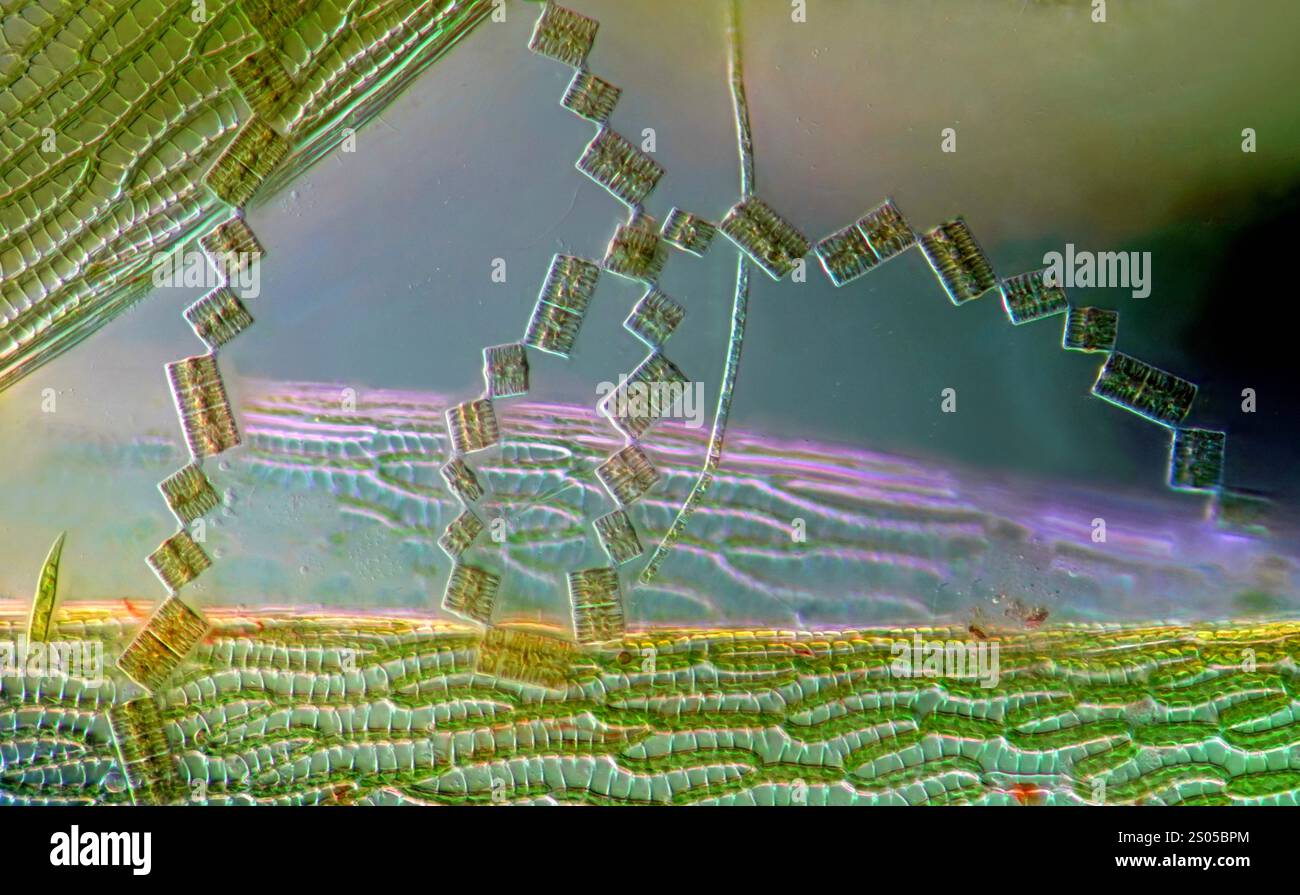 Polarised light micrograph of Tabellaria sp. diatoms and Sphagnum sp ...