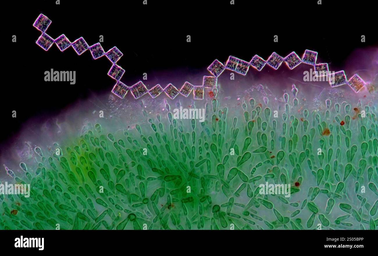 Polarised light micrograph of Tabellaria sp. diatoms and ...
