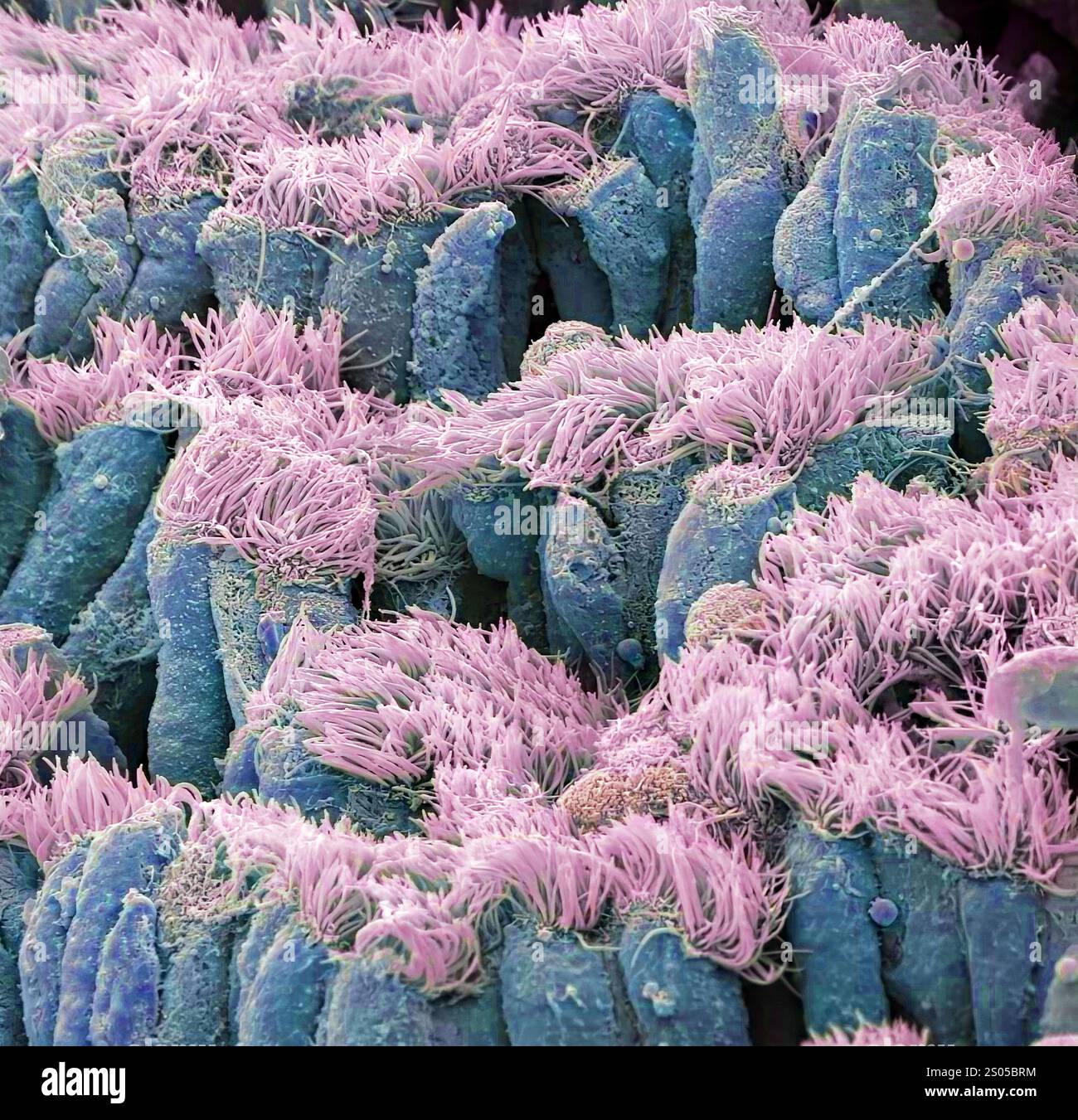 Nasal epithelium, coloured scanning electron micrograph (SEM). The ...