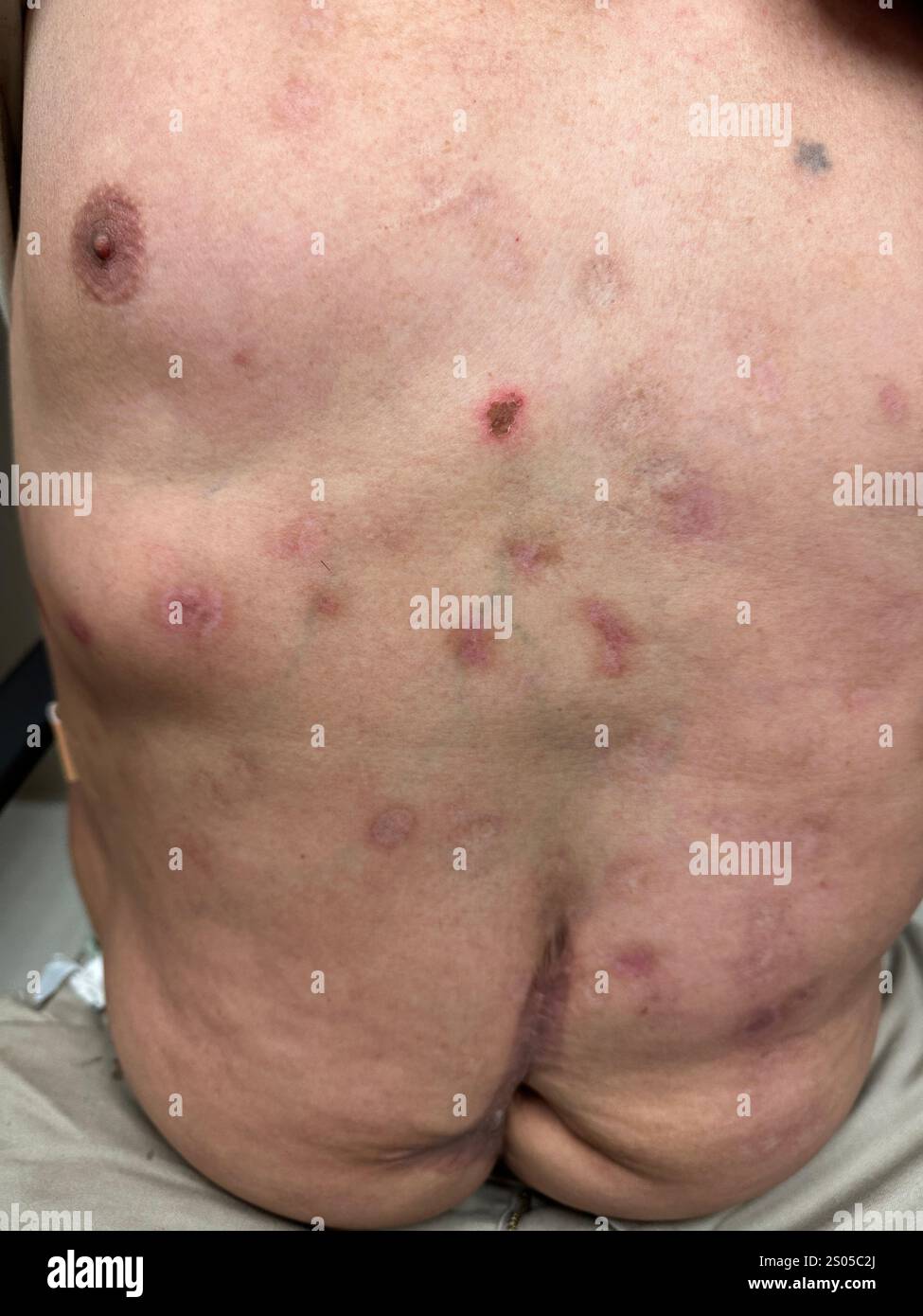 Not to be used for advertising or in a defamatory context Back of a ...