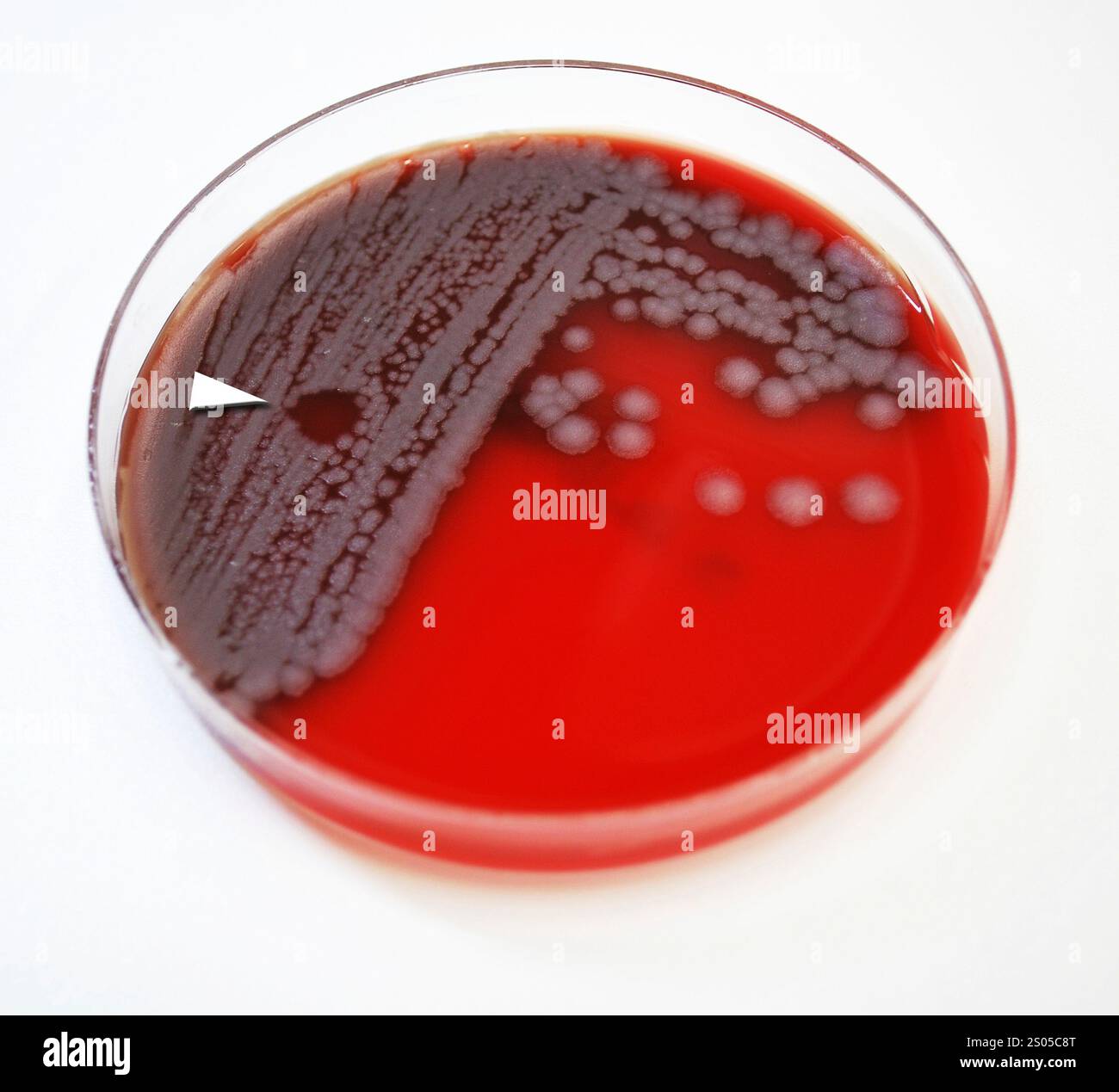 Bacillus anthracis bacterial colonies that have been growing on sheep’s ...