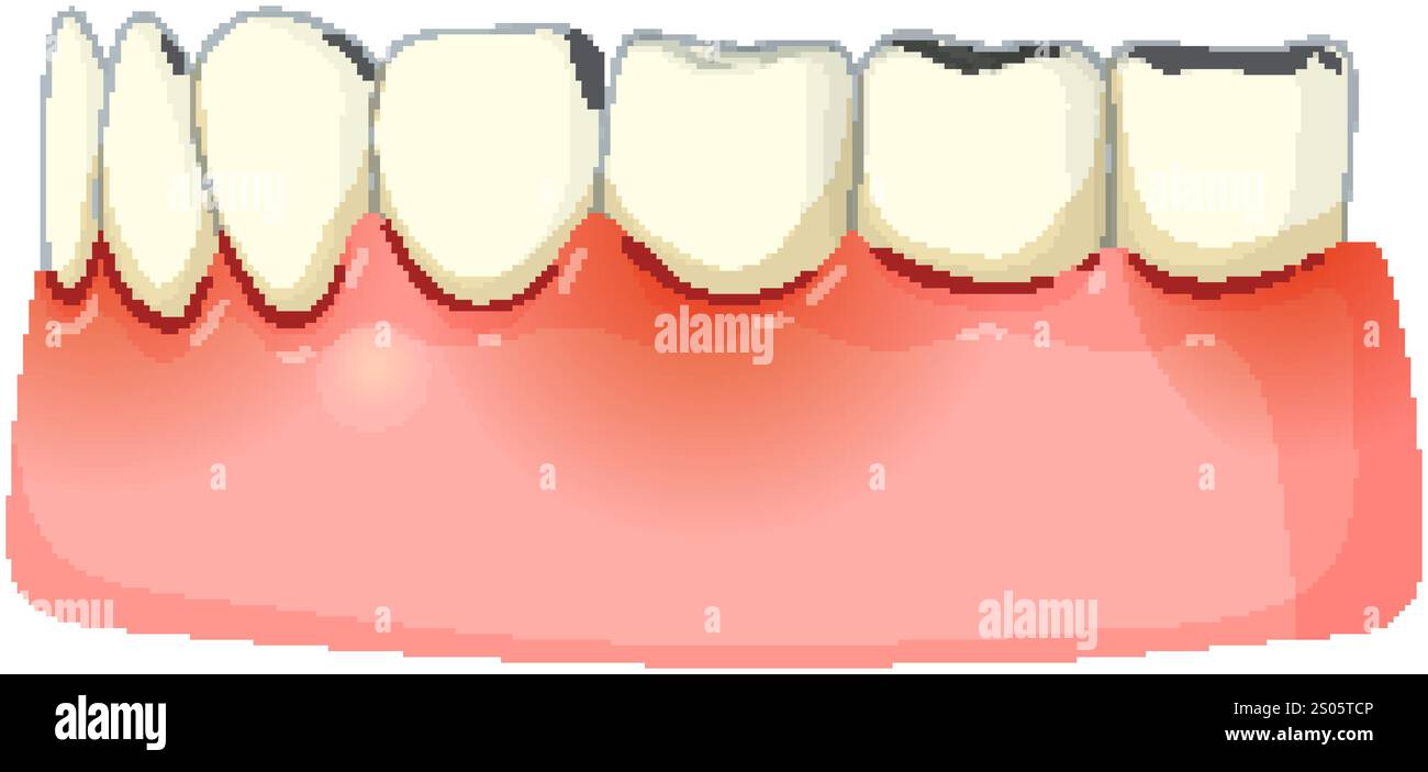 Vector art of teeth and gums for dental health Stock Vector Image & Art ...