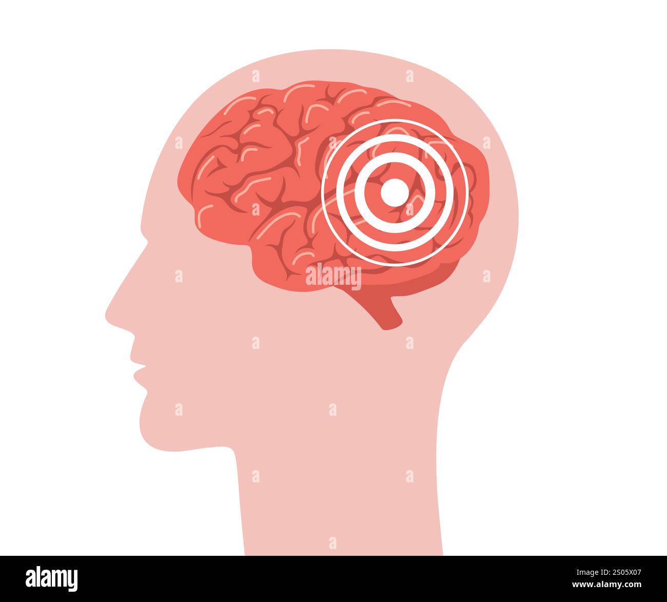 Brain anatomy. Human head in profile with red brain inside. Headache ...