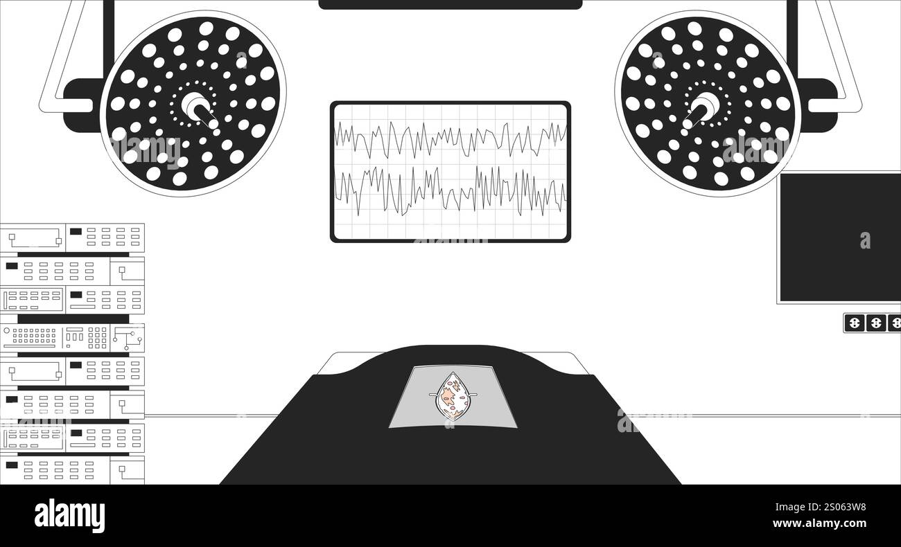Empty operating theater black and white line illustration Stock Vector ...