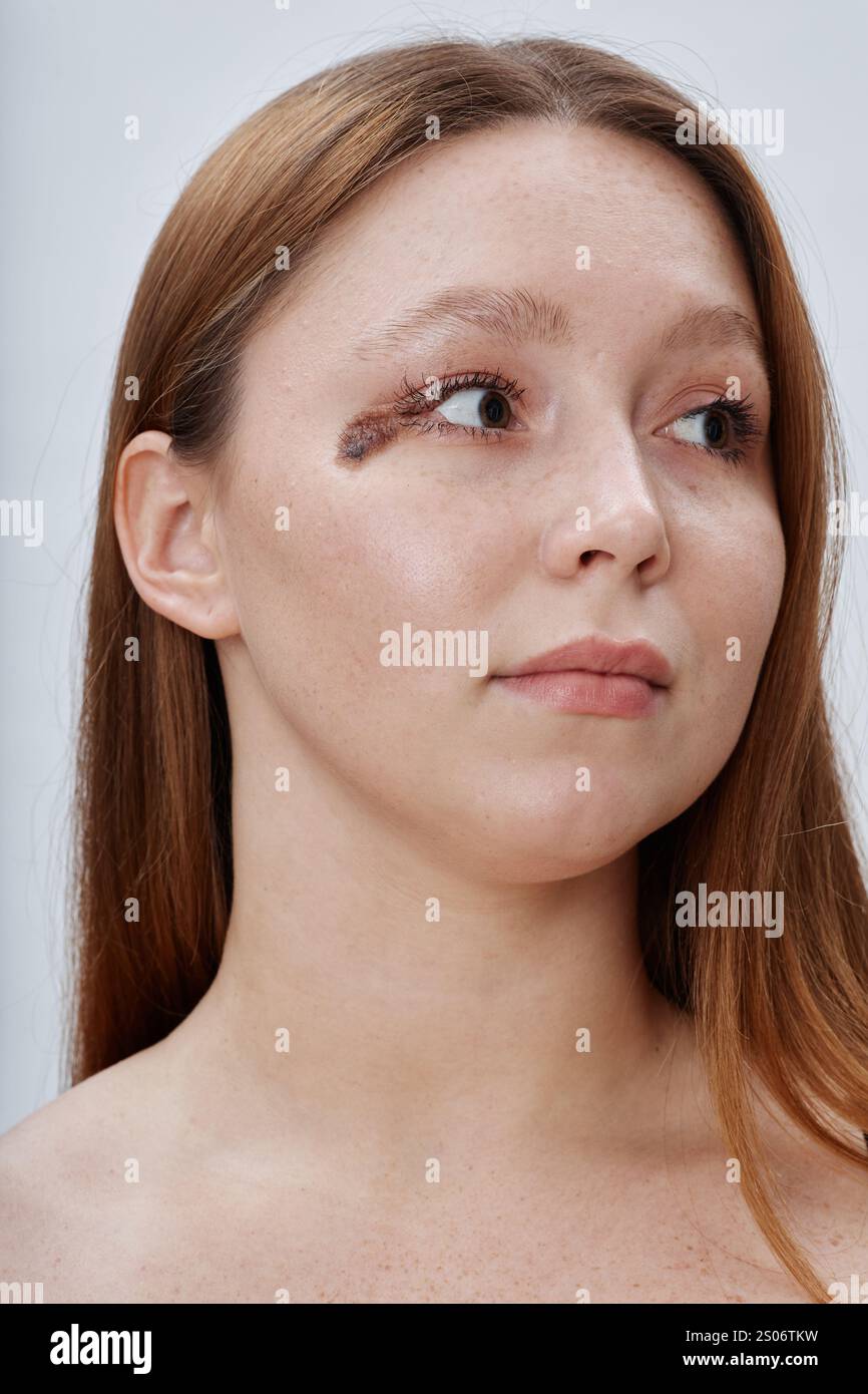 Vertical portrait of pretty ginger haired girl with face birthmark ...