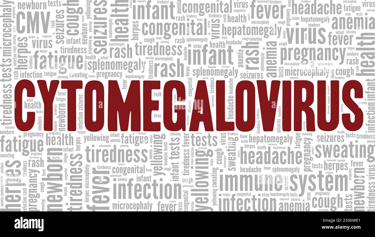 CMV Cytomegalovirus word cloud conceptual design isolated on white ...