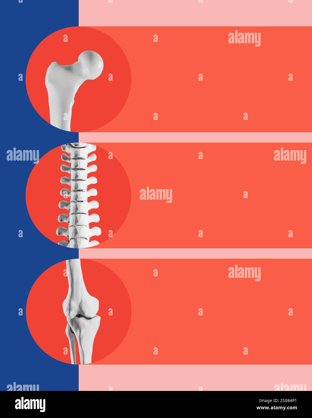 Poster. Contemporary art collage. Three skeletal elements such as hip ...