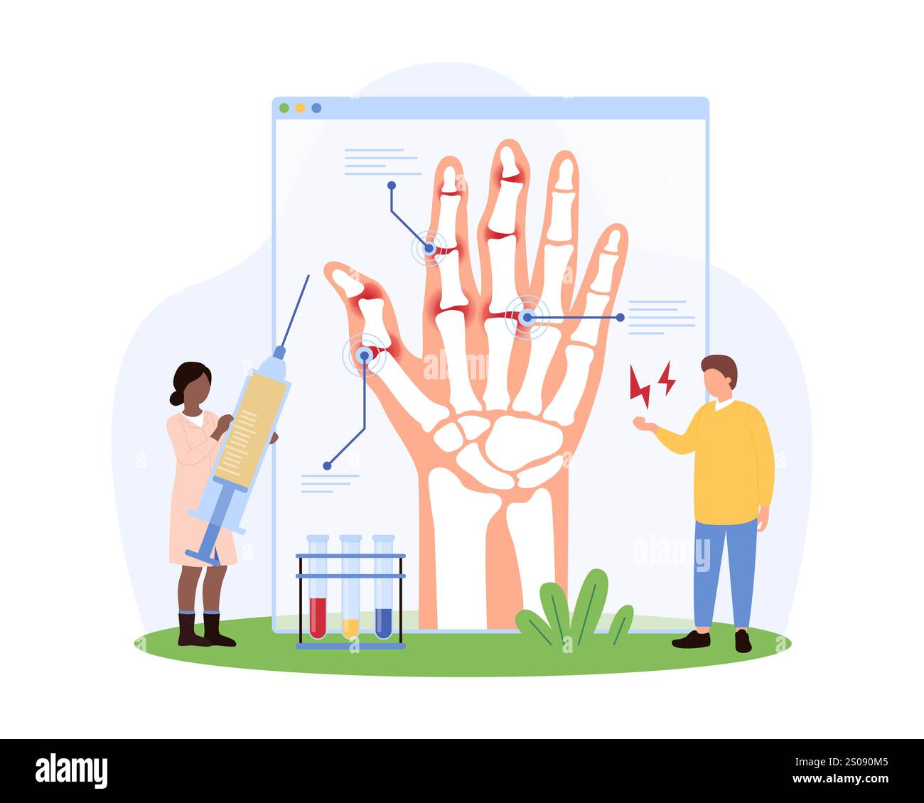 Doctors diagnosing hand arthritis using X-ray and medical tools ...