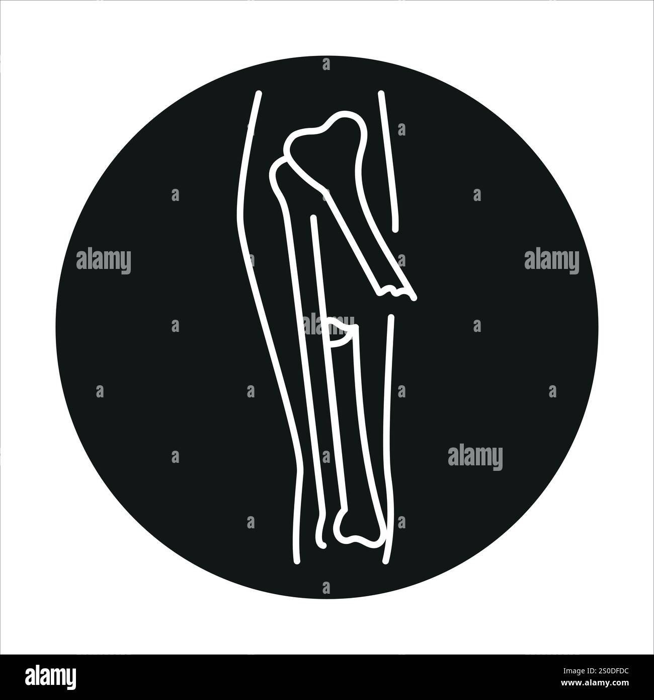 Healthcare medicine bone fractures Stock Vector Images - Alamy