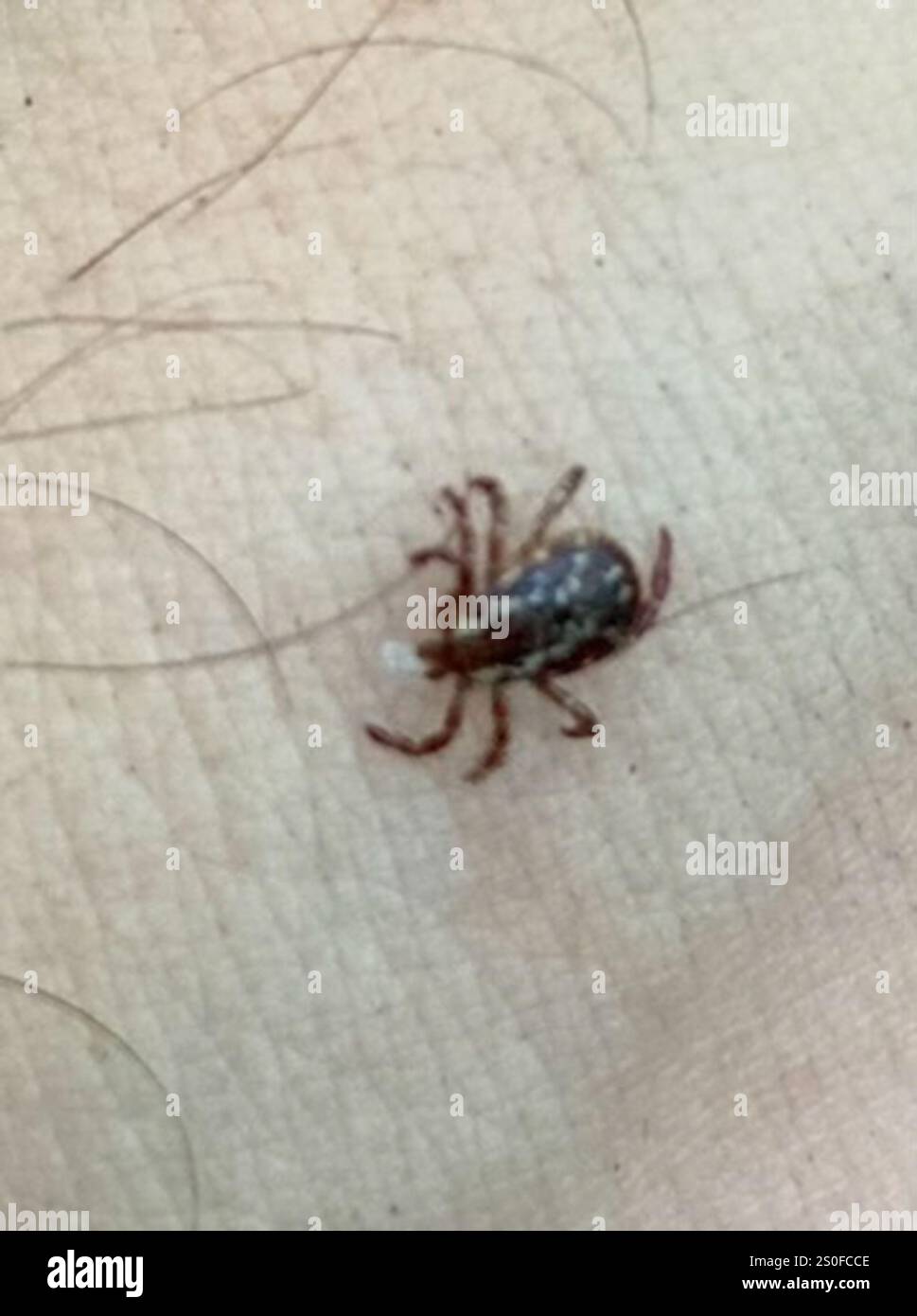 American Dog Tick (Dermacentor variabilis Stock Photo - Alamy