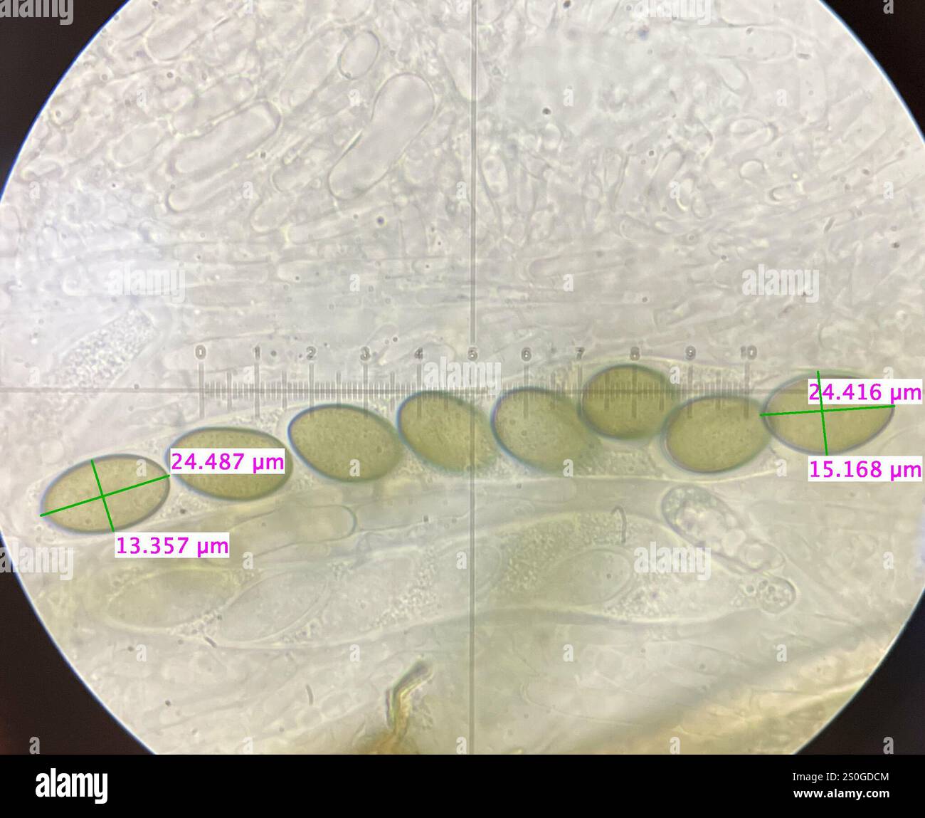 dung button (Poronia erici Stock Photo - Alamy