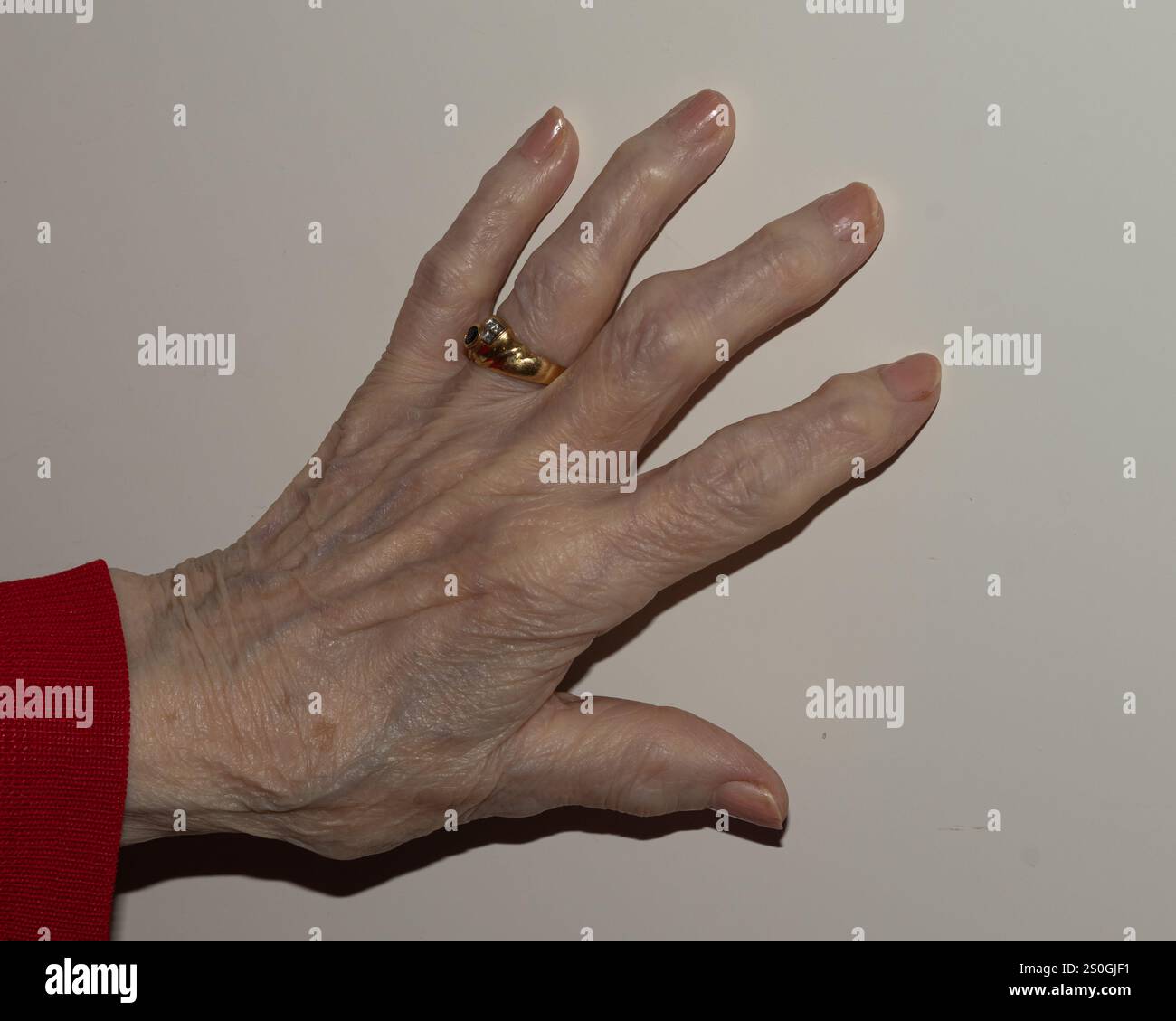 Close-up view of an elderly woman's hand, showing detailed skin texture ...