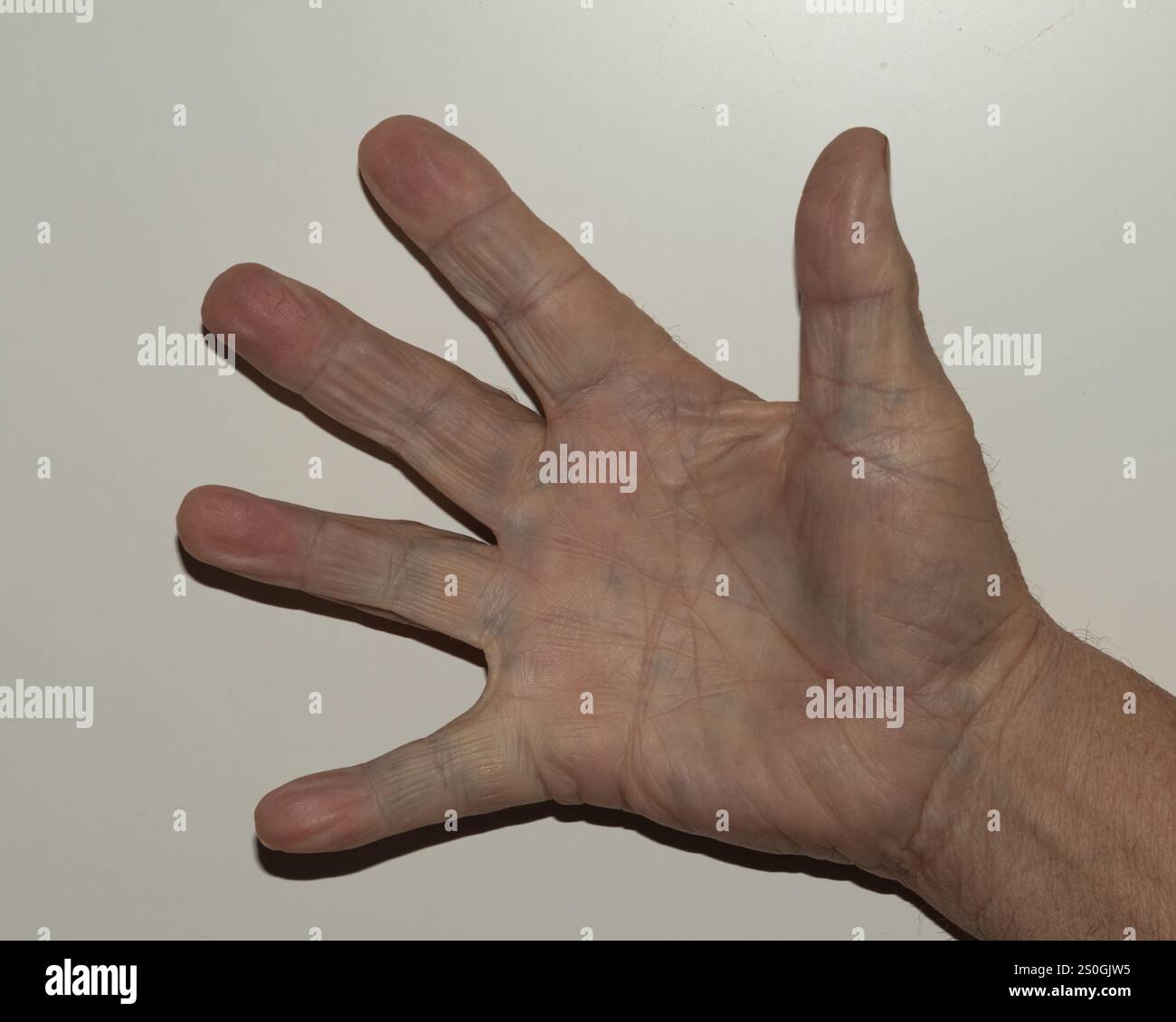 Close-up view of an elderly, fully open hand against a neutral ...