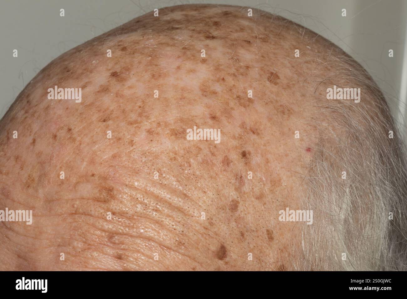 Detailed close-up of an elderly individual's head, focusing on the ...