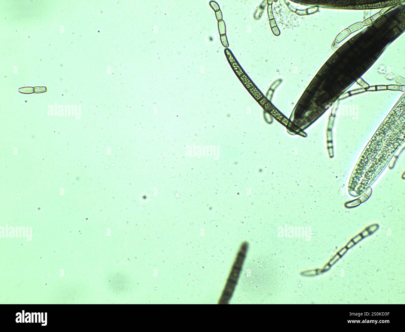 Earth Tongues (Geoglossum Stock Photo - Alamy