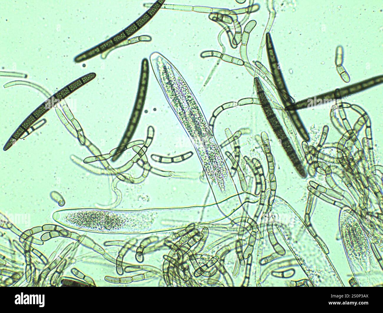 Earth Tongues (Geoglossum Stock Photo - Alamy