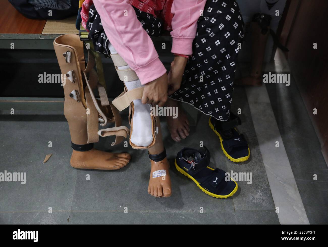 Kolkata, West Bengal, INDIA. 29th Dec, 2024. An amputee wears her new ...