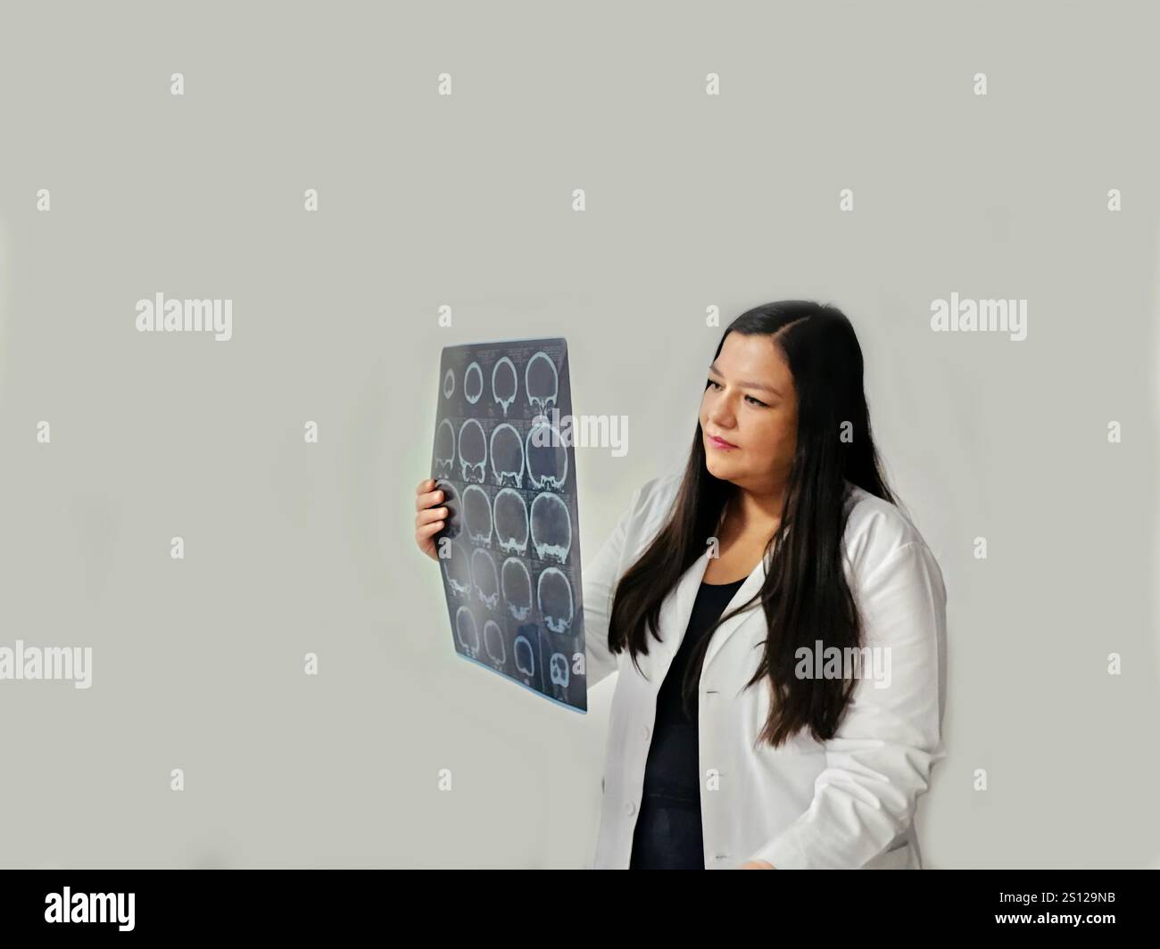 Female neurologist specialist doctor evaluates brain angiography x-ray ...